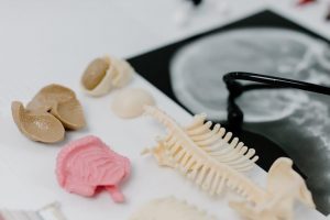 Algebra 1 EOC Practice Test with Answers | Free PDF Download